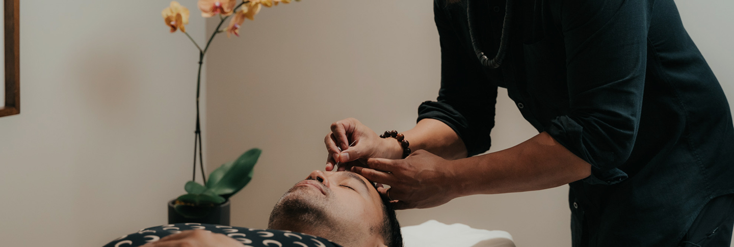 Neuropuncture™ Vallejo, CA - Ritual Acupuncture